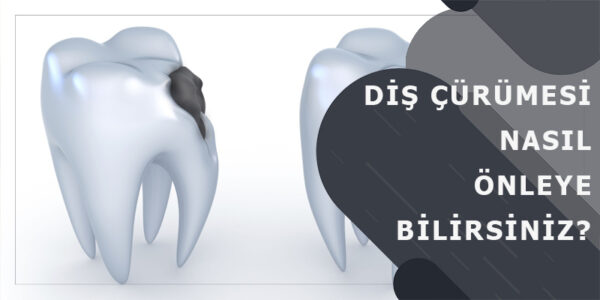 Diş Çürümesi Nasıl Önleyebilirsiniz? - Dentia Diş Kliniği