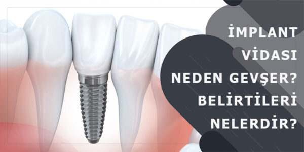 İmplant Vidası Neden Gevşer? Belirtileri Nelerdir? - Dentia Klinik